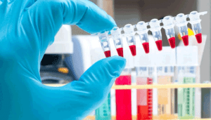 ¿Qué es el antidoping? | CEEAD Laboratorios Texmelucan