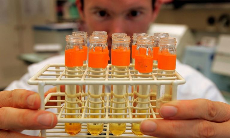¿Qué son las pruebas de antidoping? Conoce todo de estos análisis. | CEEAD